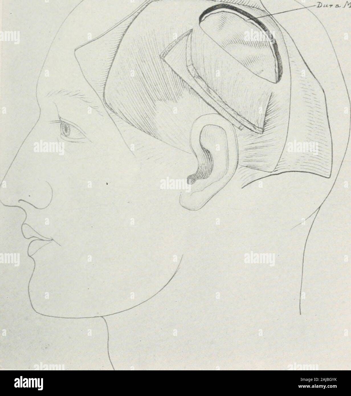 Temporal fascia hi-res stock photography and images - Alamy