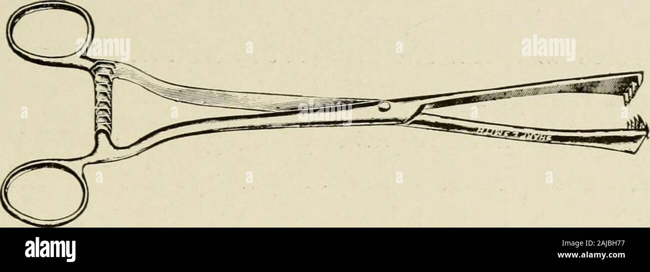 Fistula of the withers and poll-evil . backward part willrest in the ...
