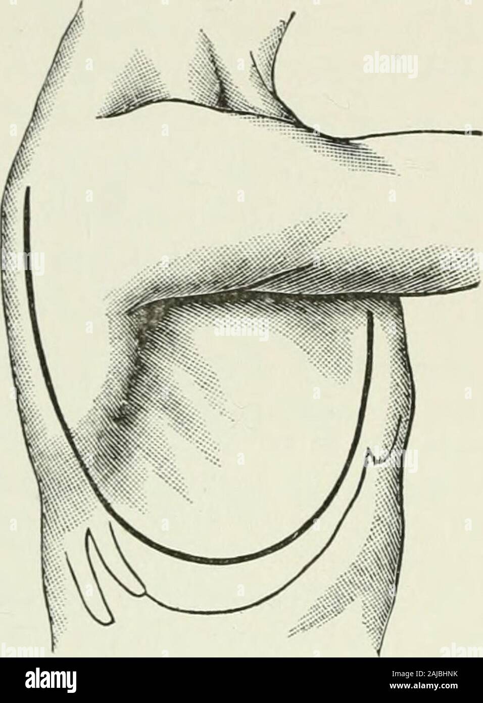 Parietal pleura hi-res stock photography and images - Alamy