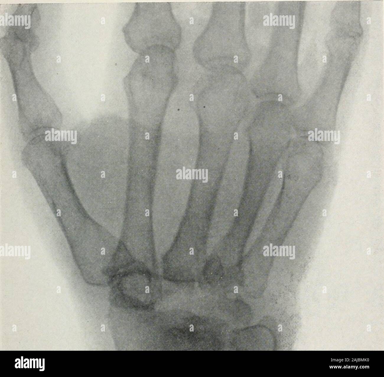 Annals of surgery . little except a slight clearingin the vipper part ...