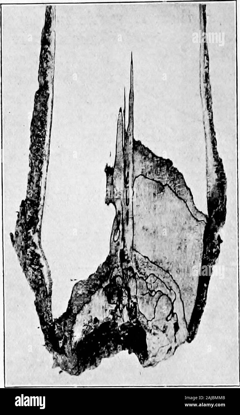 Mycelium Black and White Stock Photos & Images - Alamy