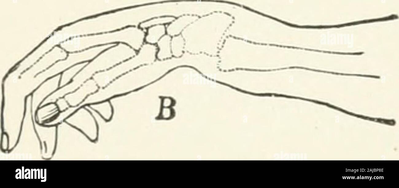 Annual and analytical cyclopaedia of practical medicine . Fig. 10 ...