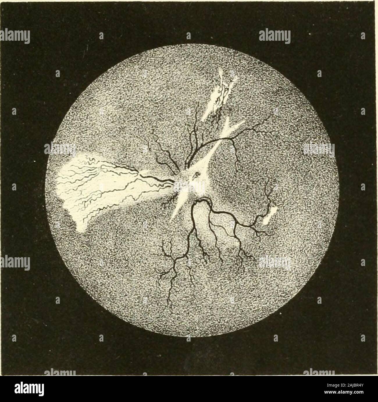 Splinter eye hi-res stock photography and images - Alamy