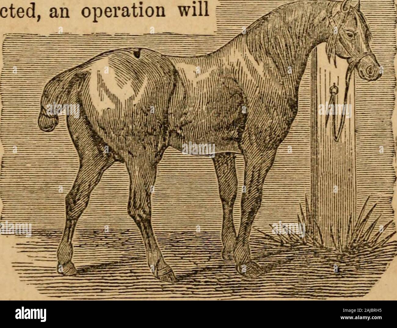 Groin hernia hi-res stock photography and images - Alamy