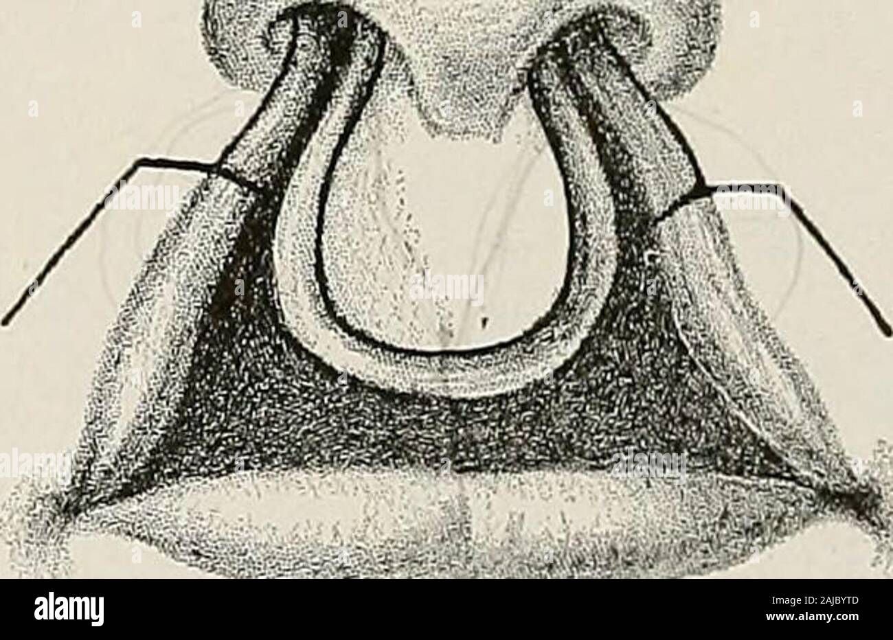 Double harelip hi-res stock photography and images - Alamy