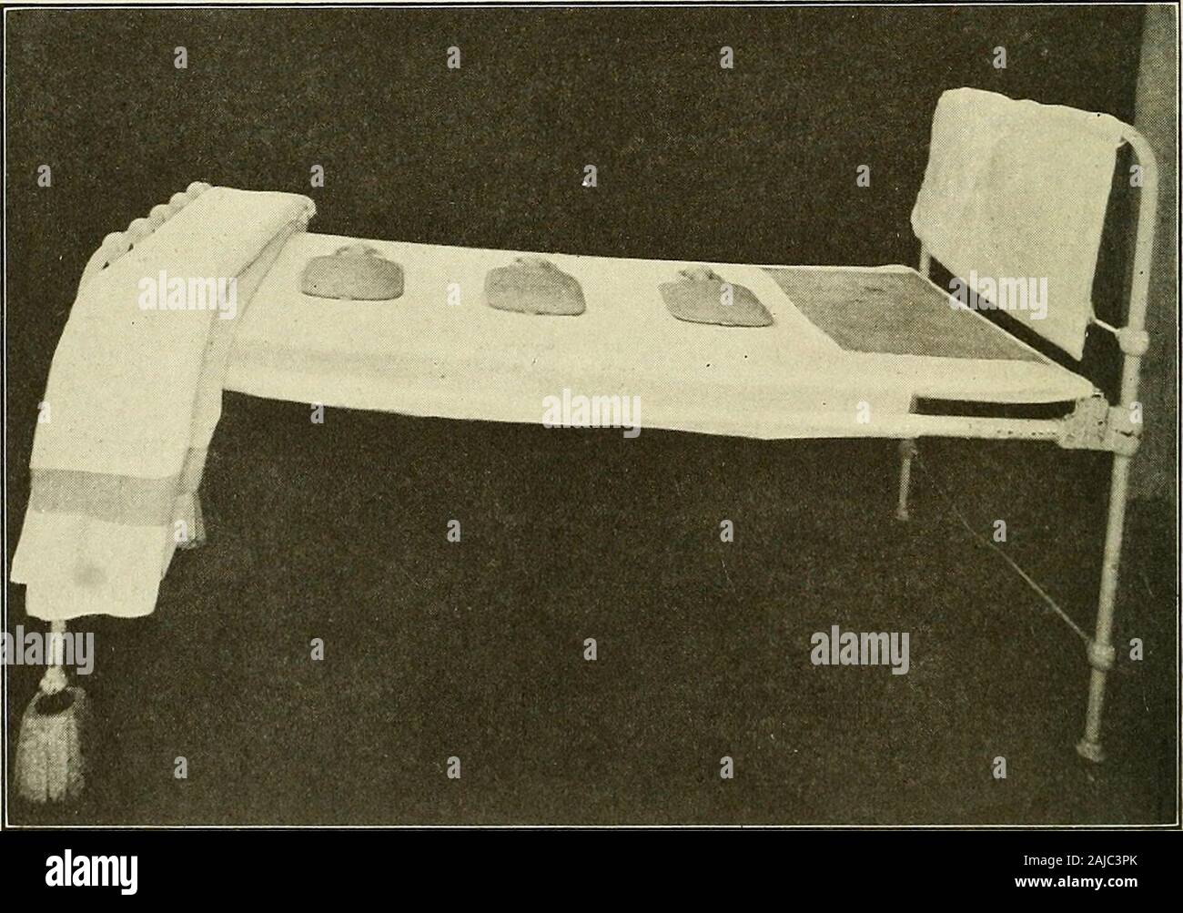 Preparatory and after treatment in operative cases . Fig. 191.—Shock ...