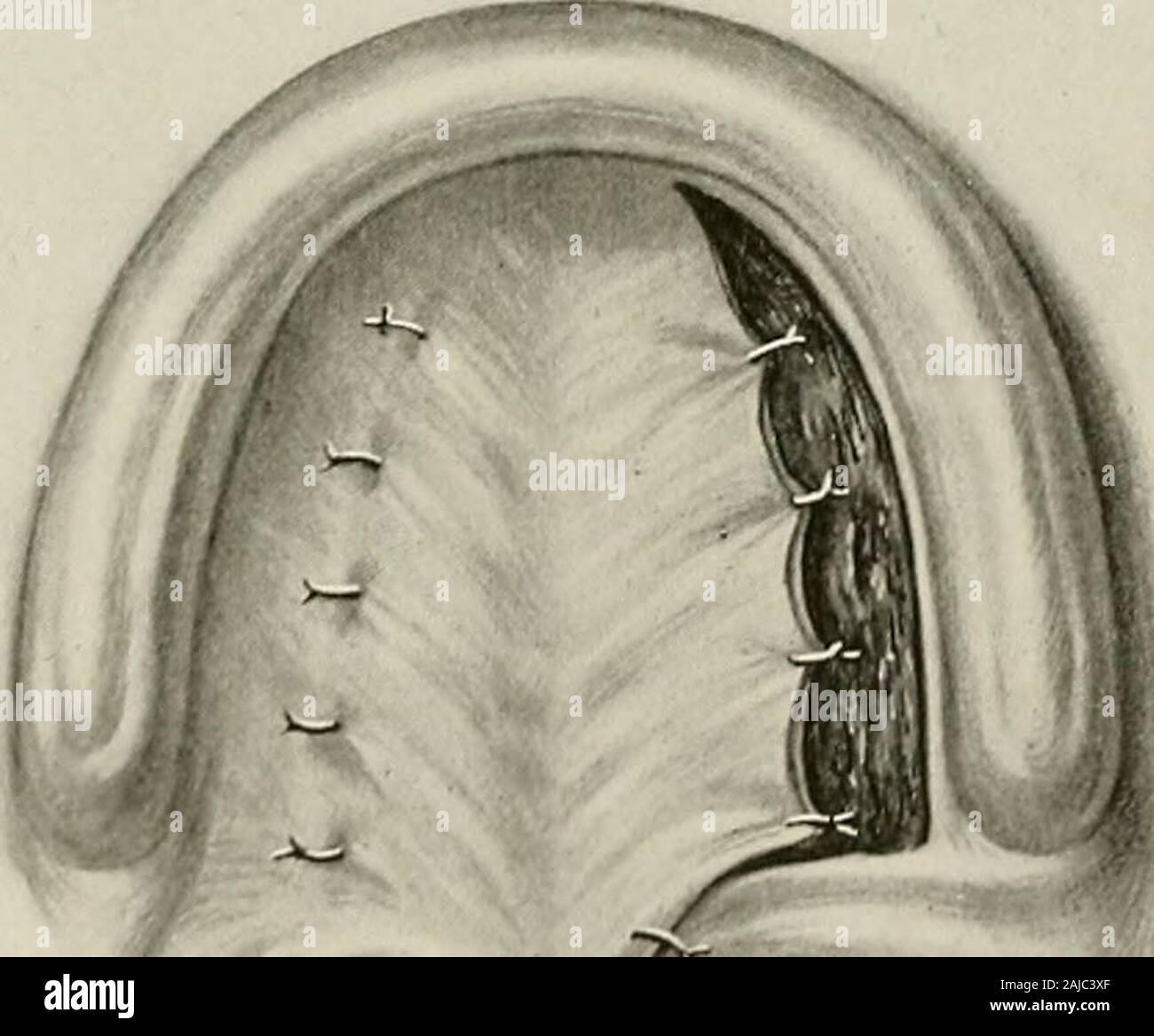 Surgical treatment; a practical treatise on the therapy of surgical ...