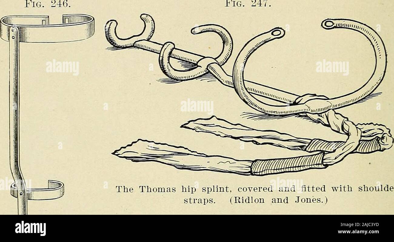 The thomas splint hi-res stock photography and images - Alamy