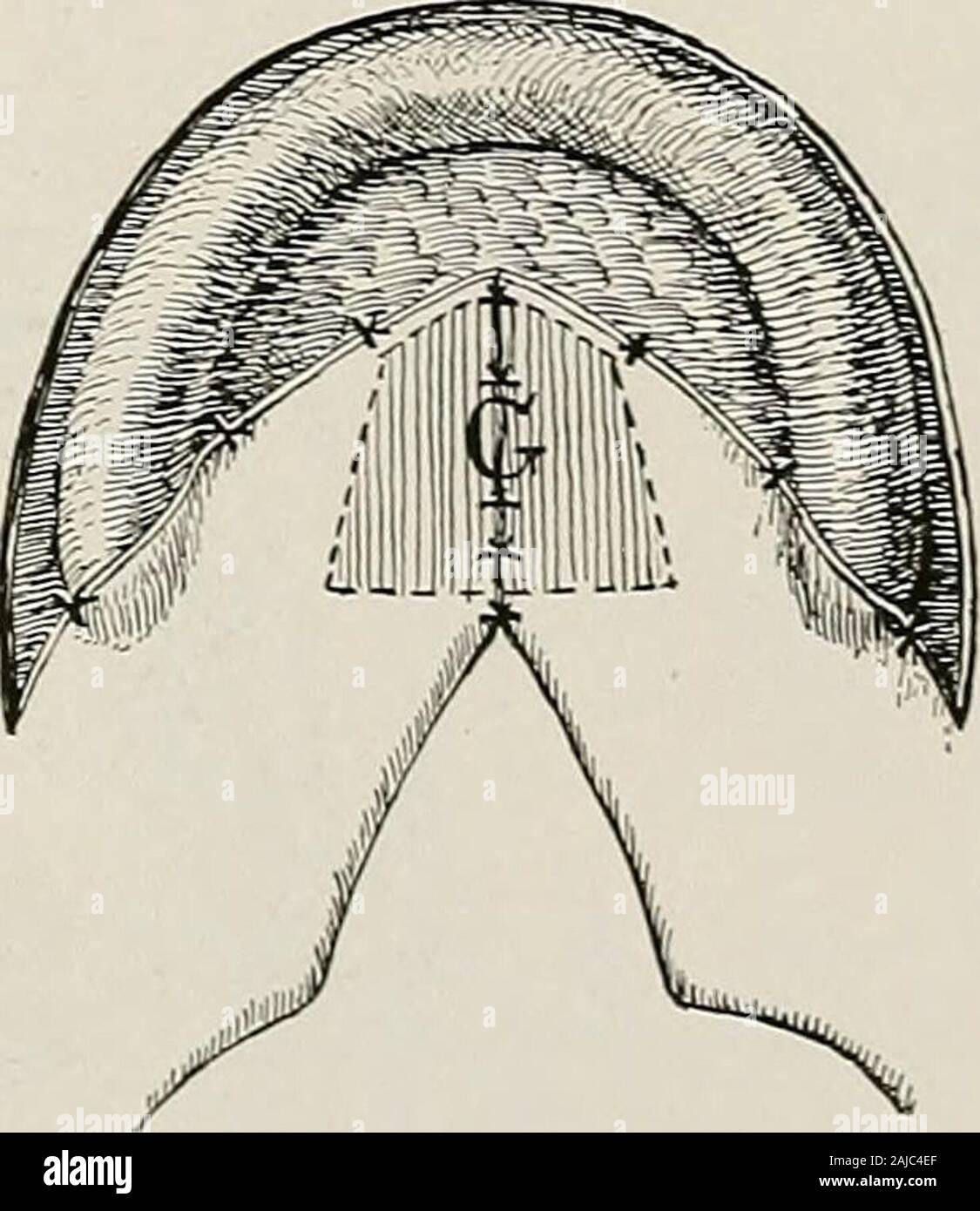 Surgical treatment; a practical treatise on the therapy of surgical ...