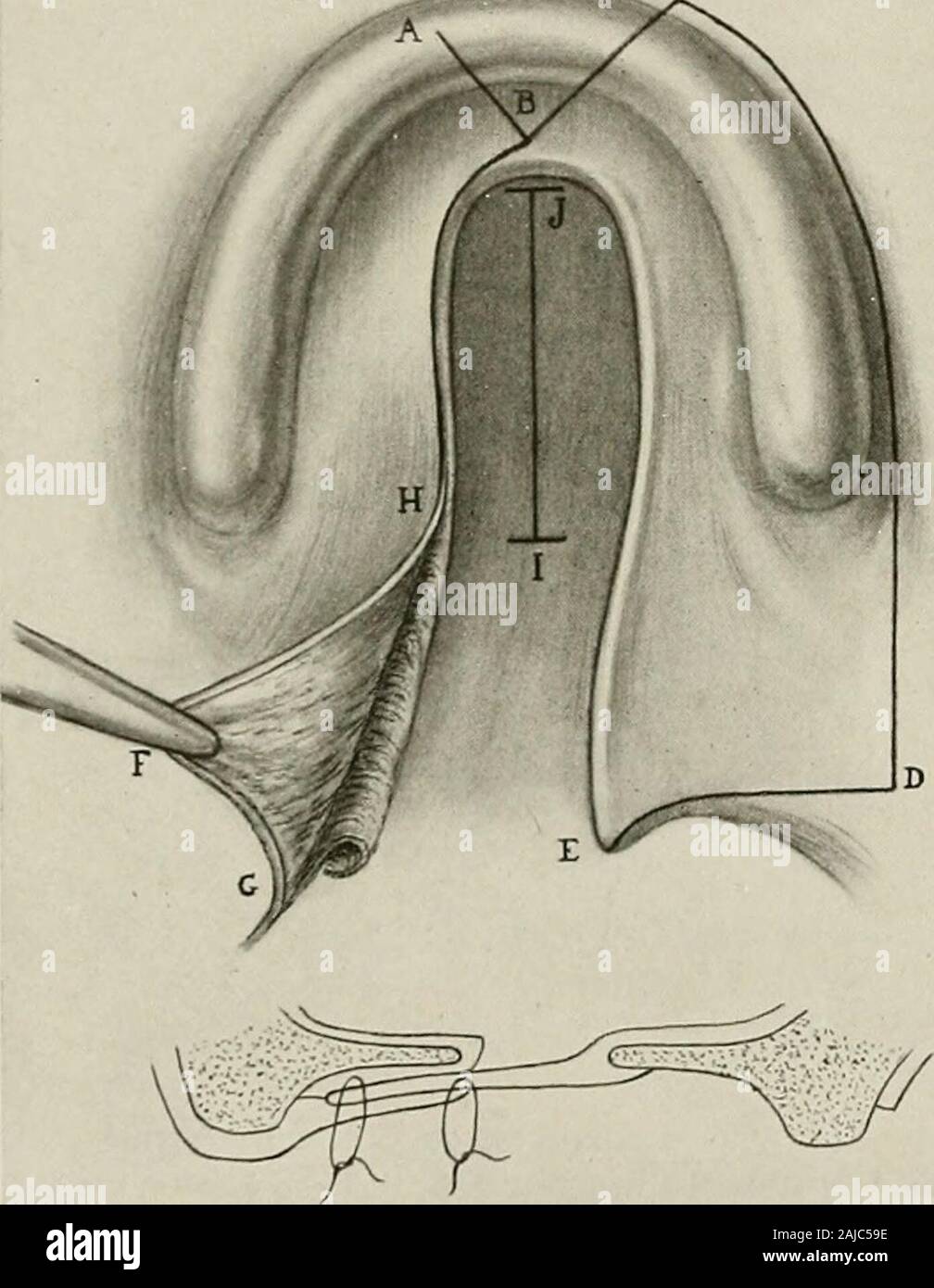 Descending palatine artery hi-res stock photography and images - Alamy