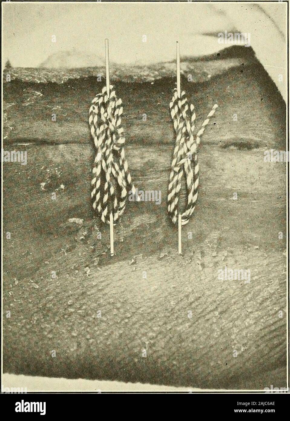 Preparatory and after treatment in operative cases . Fig. 183.—Suture ...