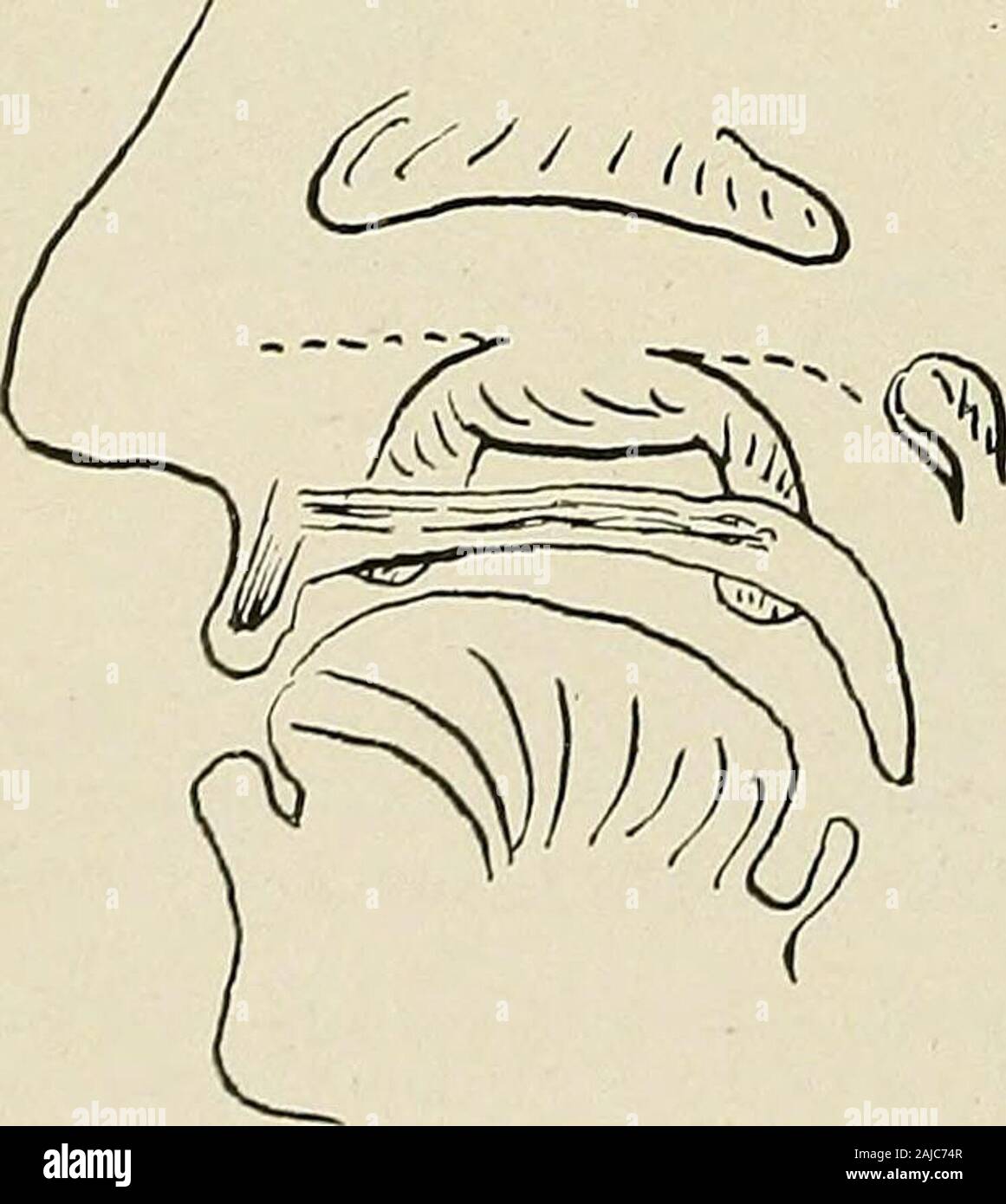 Cheek flaps hi-res stock photography and images - Alamy