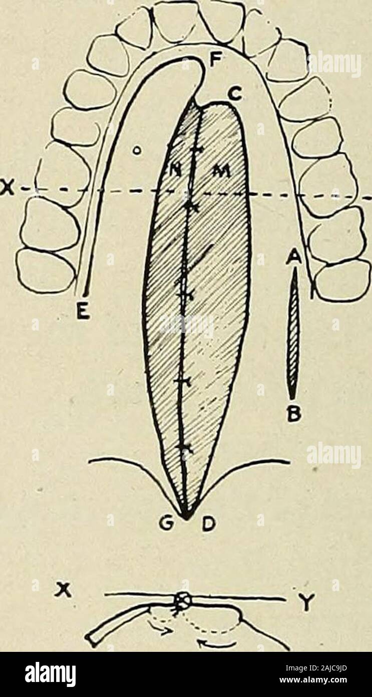 Plastic surgery; its principles and practice . ^^ ^ Stock Photo - Alamy
