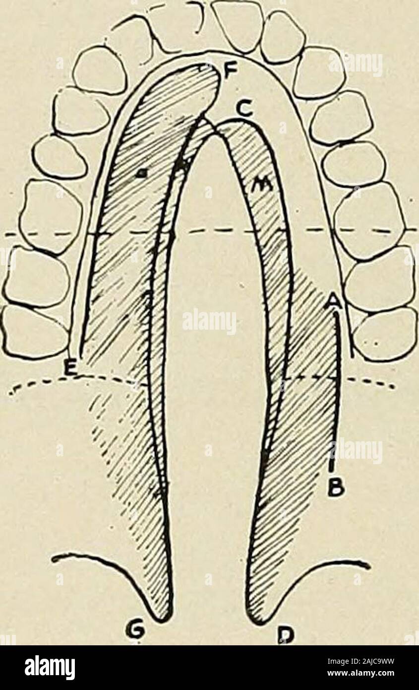 Narrowing margins hi-res stock photography and images - Alamy