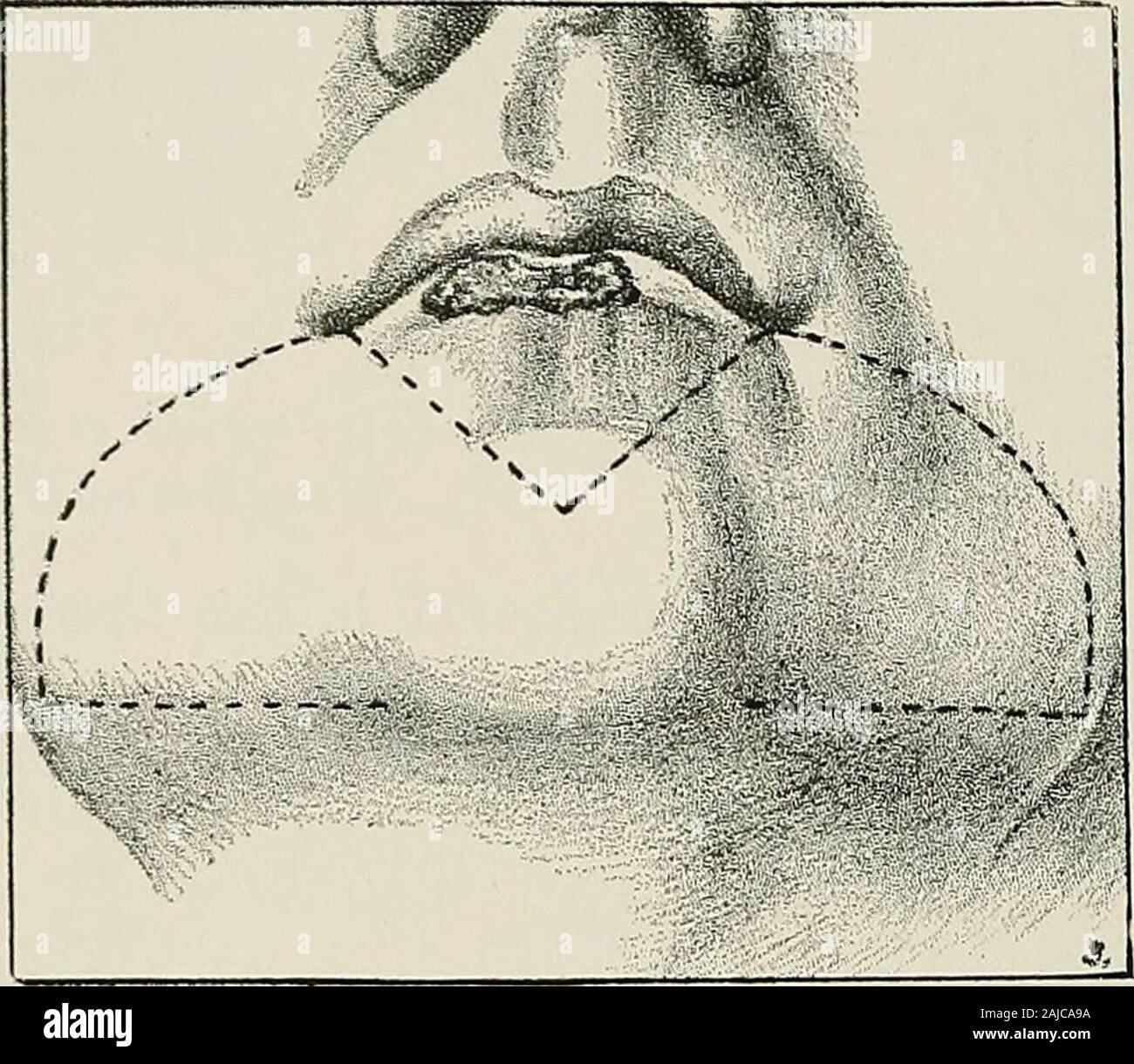 Additional therapy hi-res stock photography and images - Alamy