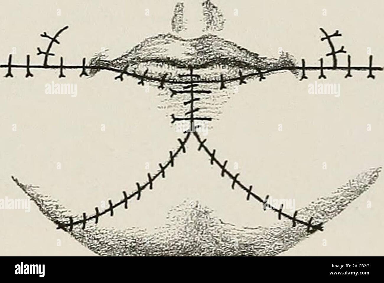 Wound provision hi-res stock photography and images - Alamy