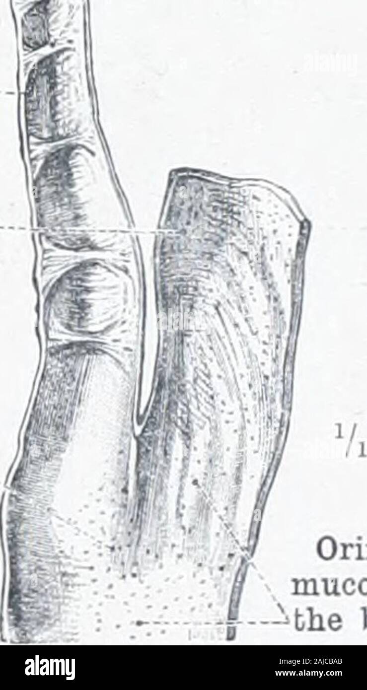An atlas of human anatomy for students and physicians . Spiral valve of ...