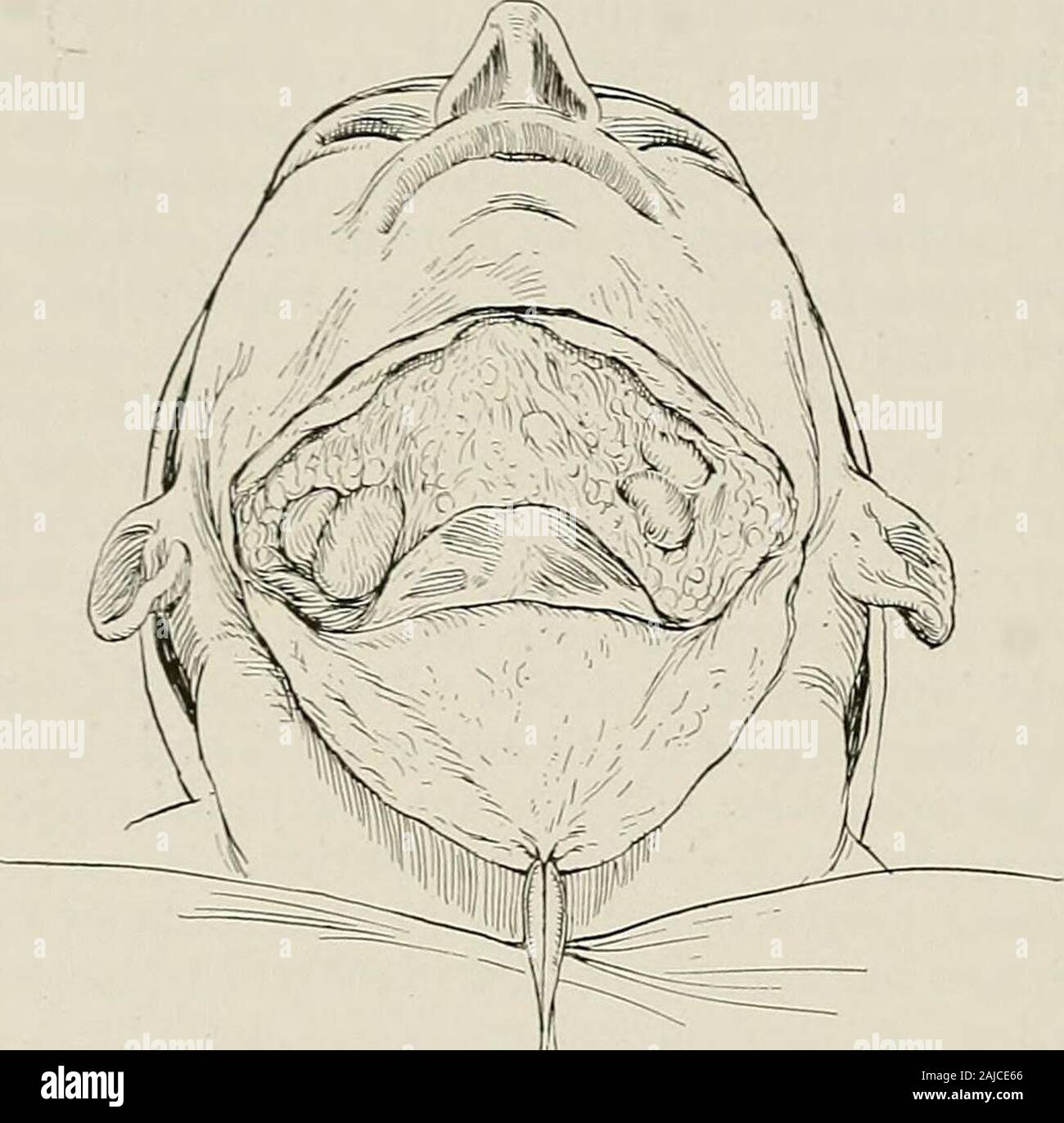 Submaxillary salivary hi-res stock photography and images - Alamy