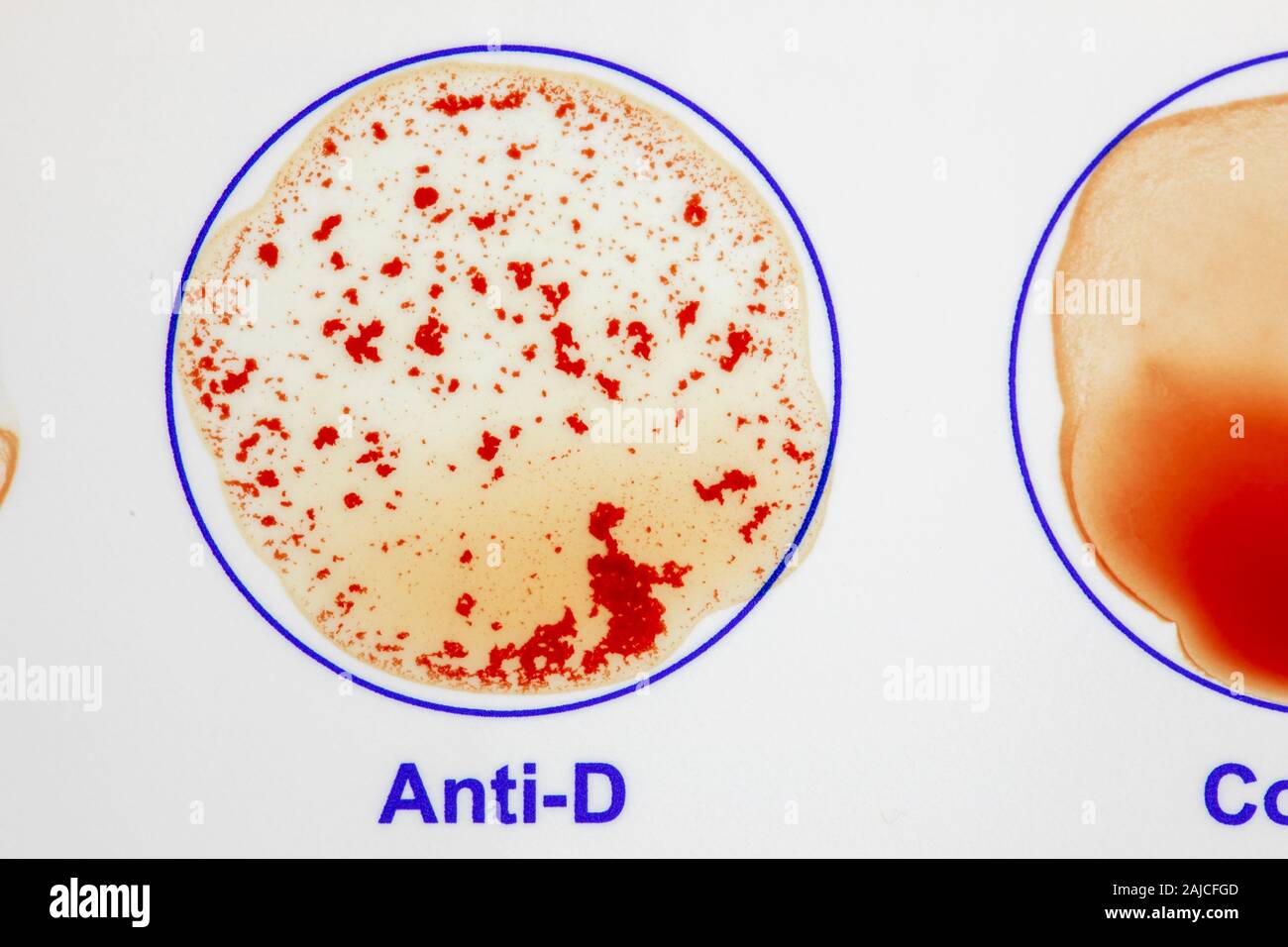 Abo blood type testing hi-res stock photography and images - Alamy