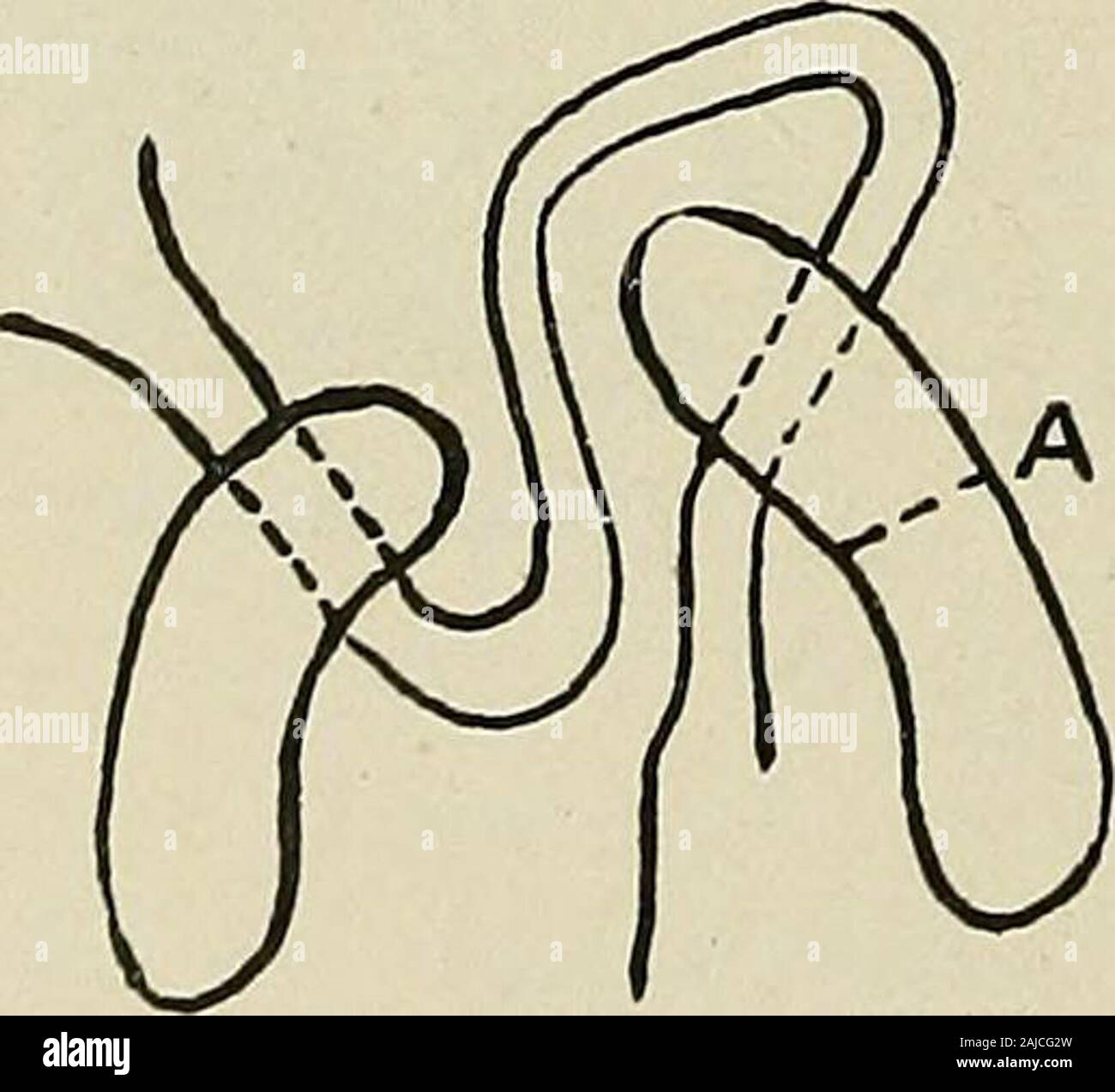 Plastic surgery; its principles and practice . sutures in the mucous ...