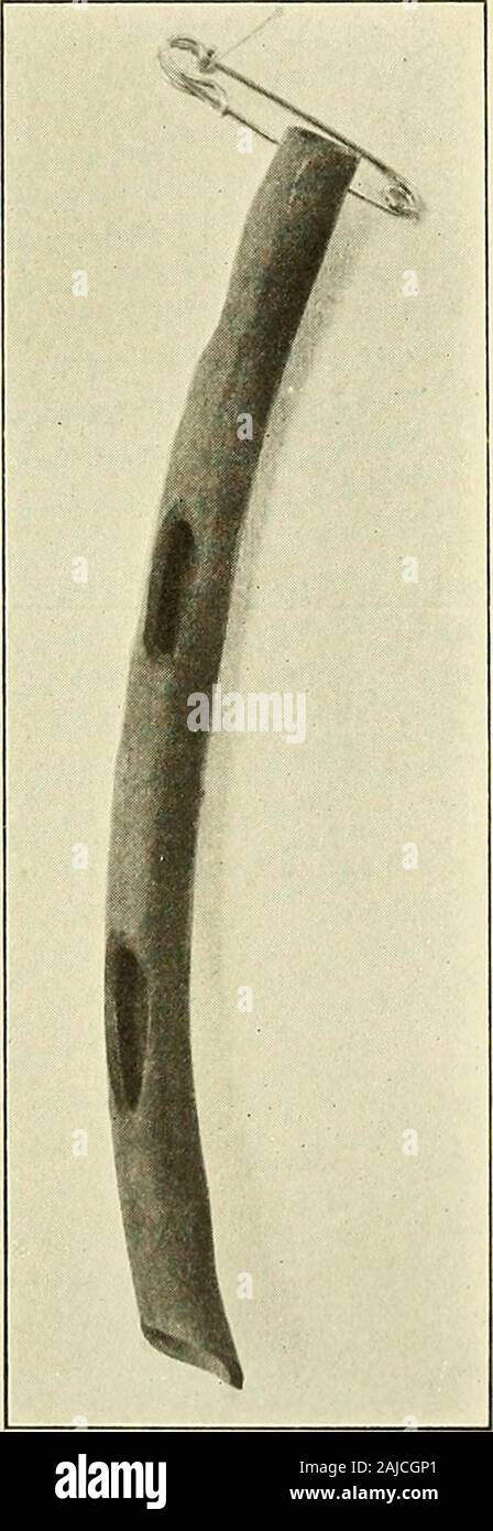 Preparatory and after treatment in operative cases . on-sterile tubing ...