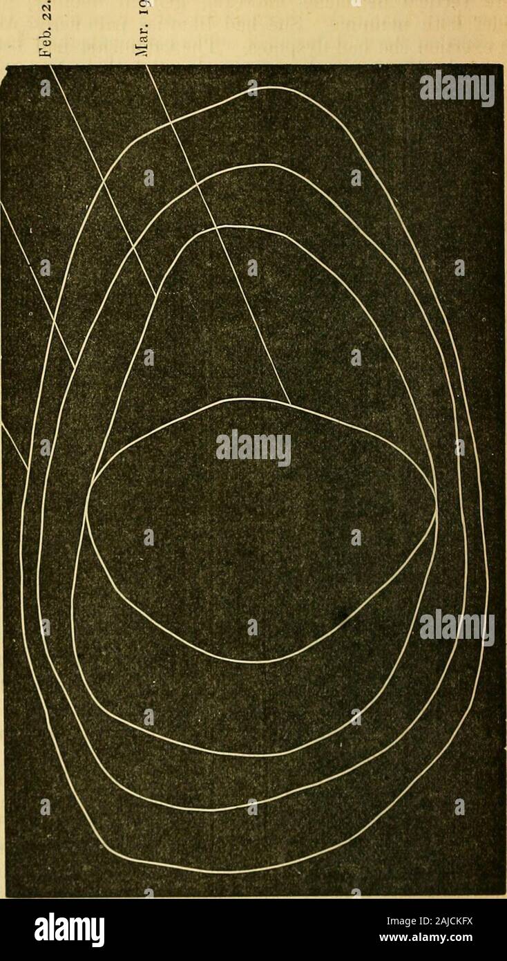 Jugular vein cardiac hi-res stock photography and images - Alamy
