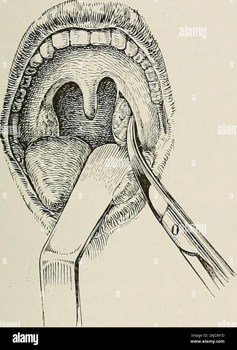 Base bleed hi-res stock photography and images - Alamy