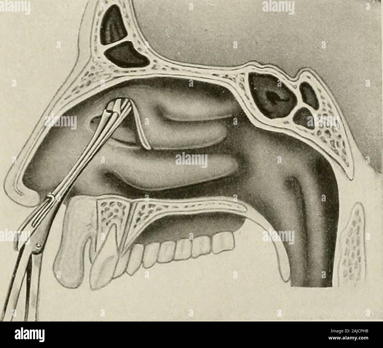 Cribriform plate hi-res stock photography and images - Alamy