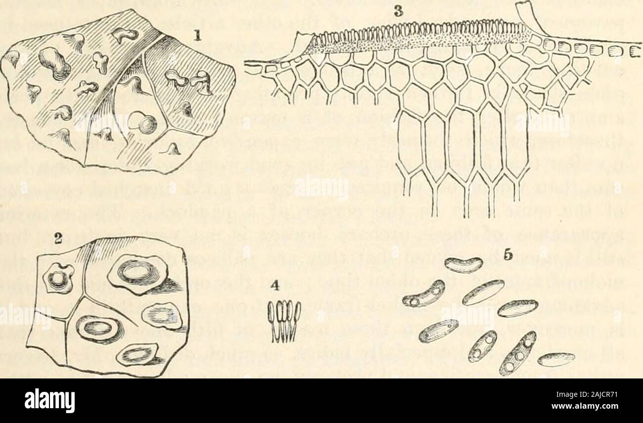 Perithecia hi-res stock photography and images - Alamy
