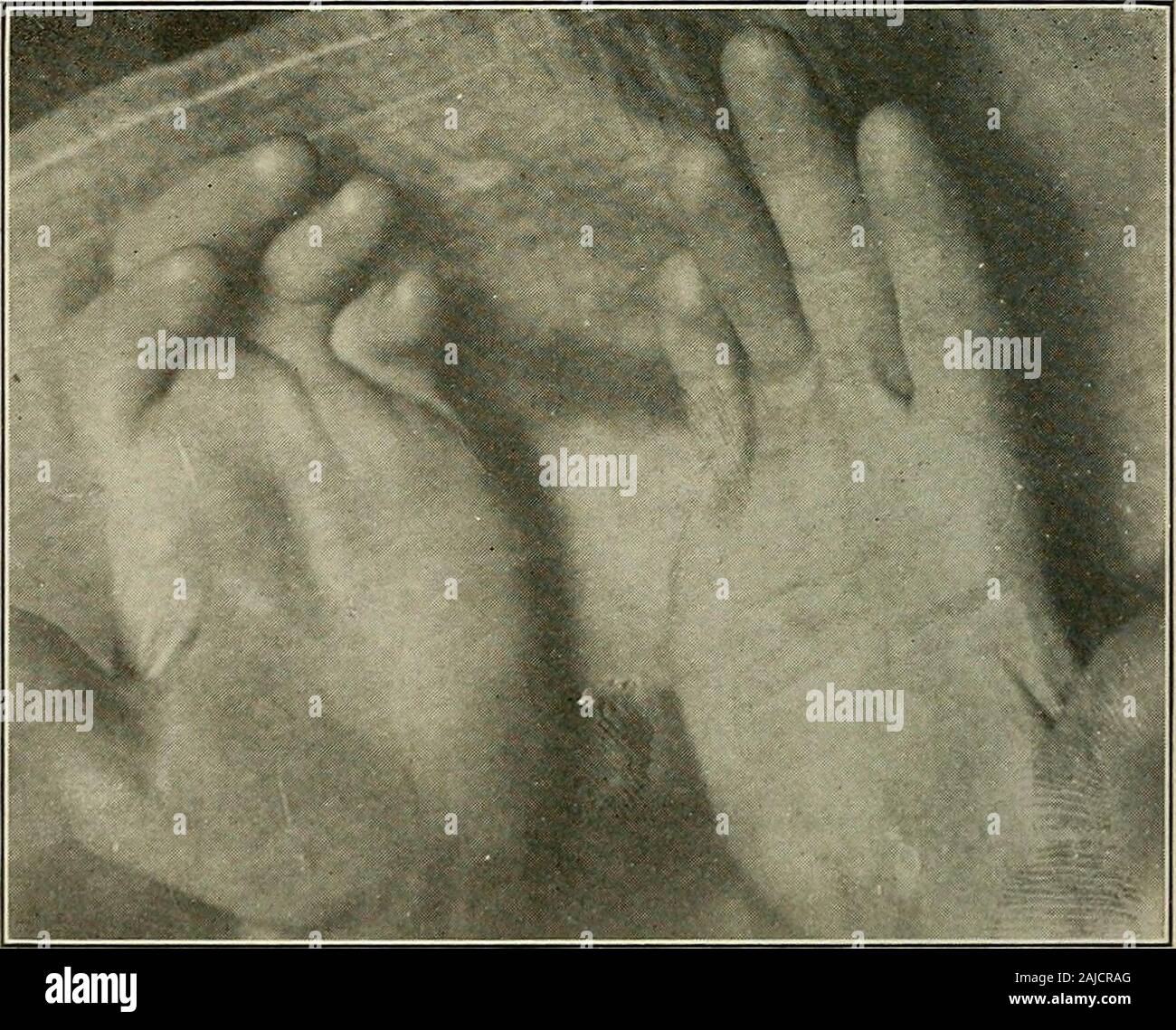 Great shortening hi-res stock photography and images - Alamy