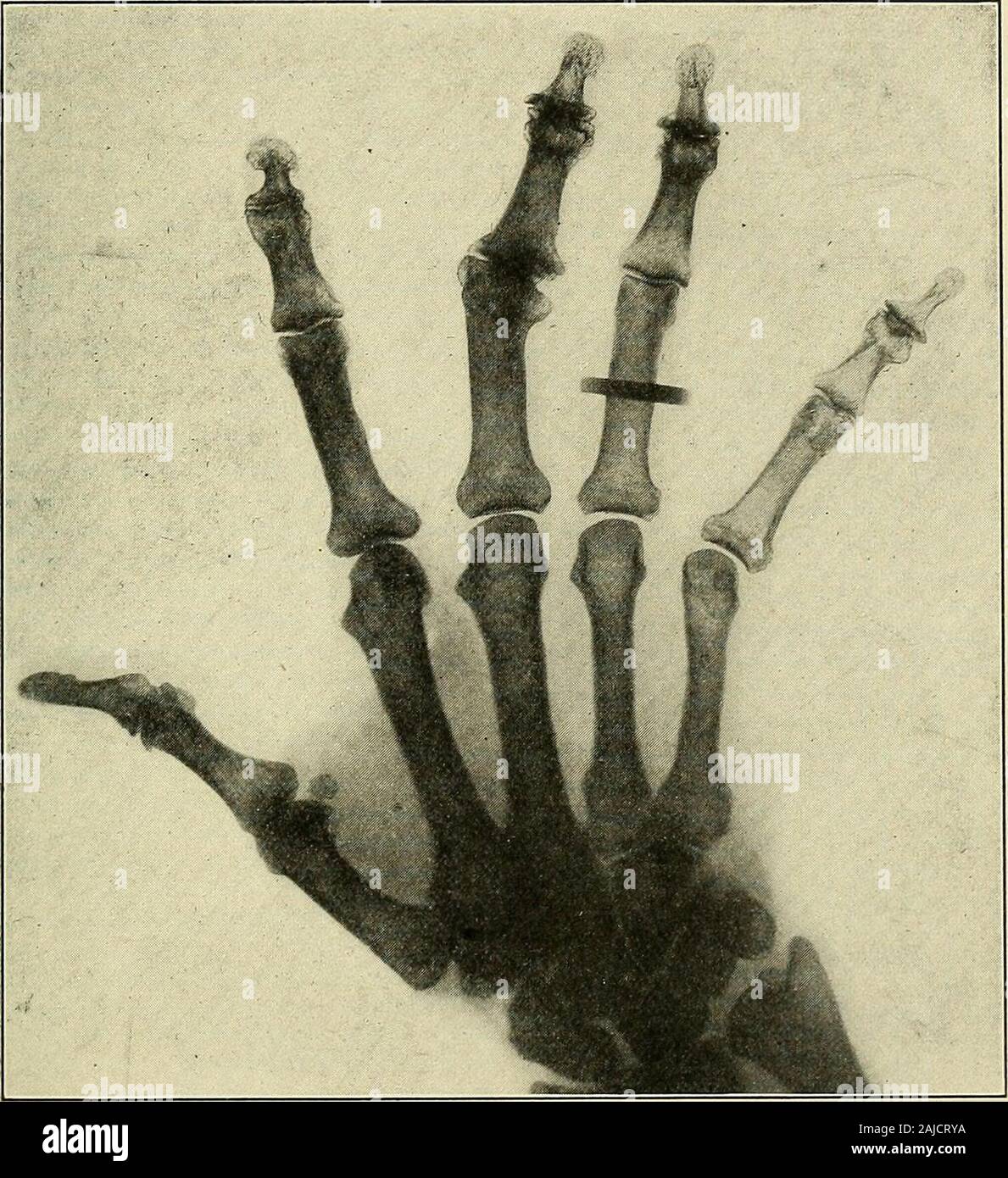 Types of joints hi-res stock photography and images - Alamy