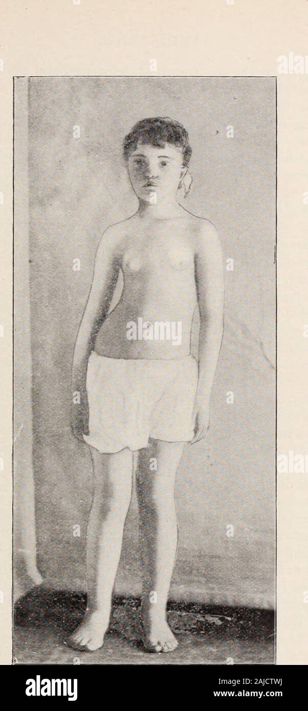 Pediatrics. . Fig r. Fig. 2. 196 PEDIATRICS. which precede the ...