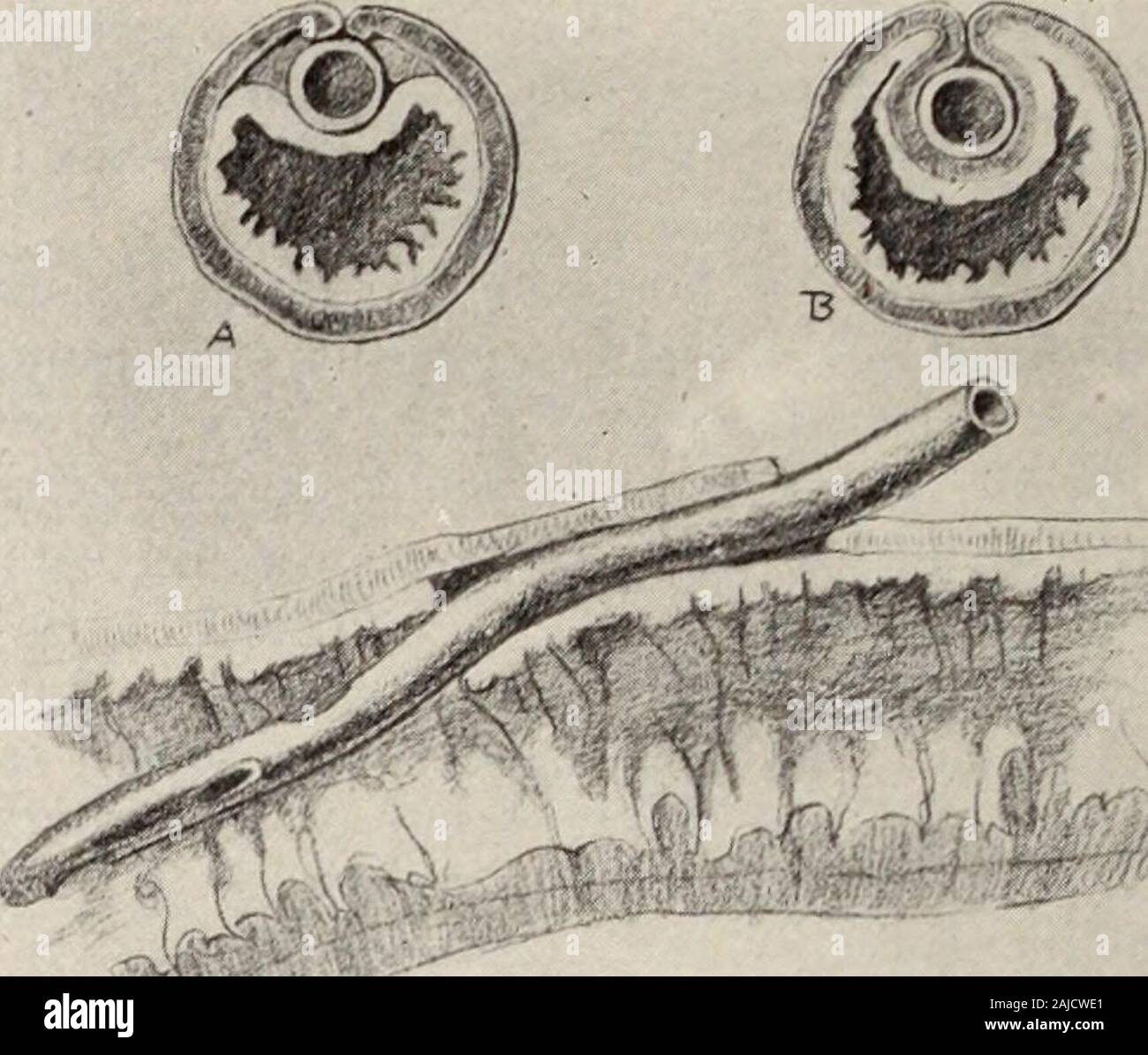 Virginia medical monthly . gh silk-worm gut sutures. The catheter will ...
