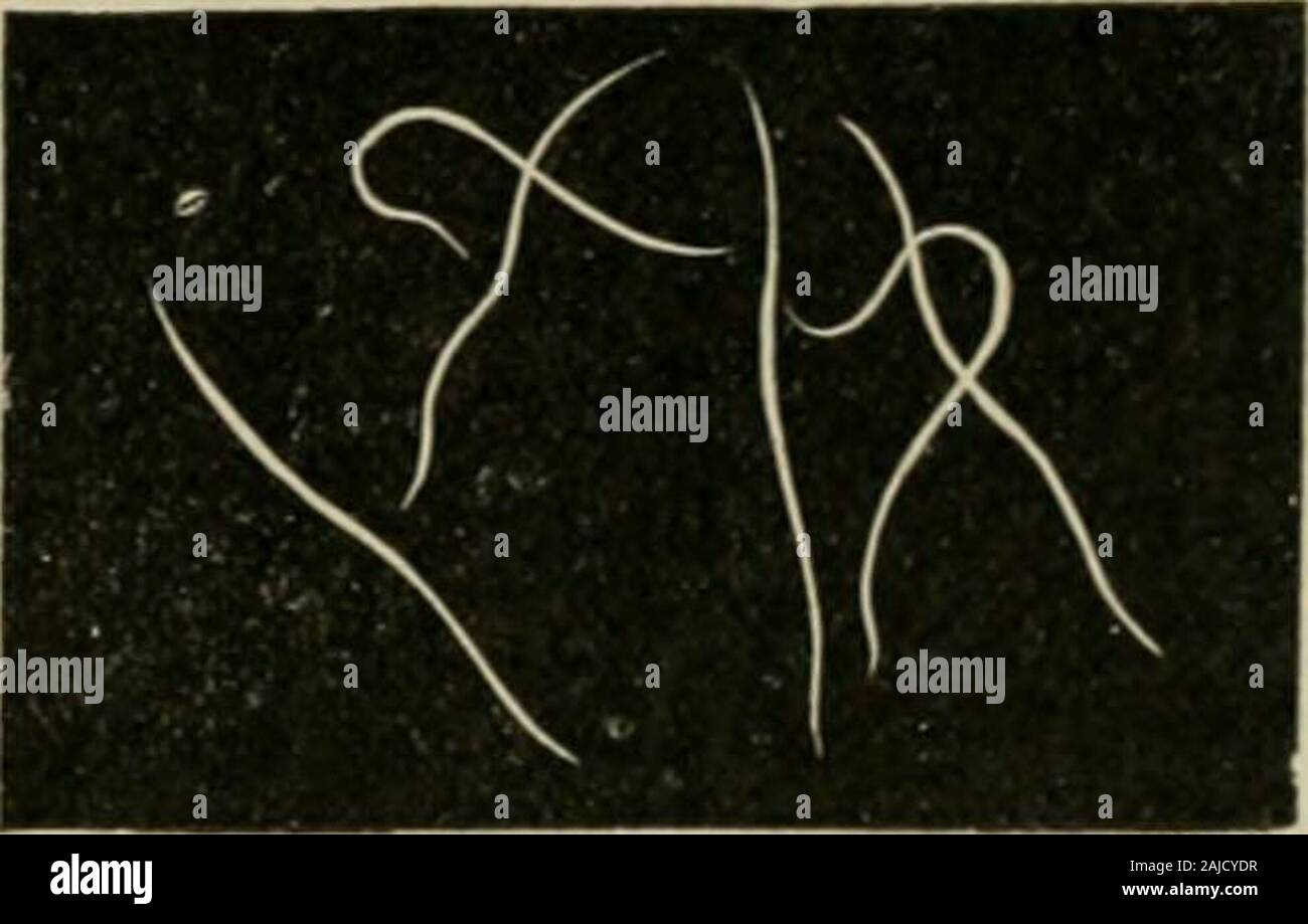 Xanthopsia hi-res stock photography and images - Alamy