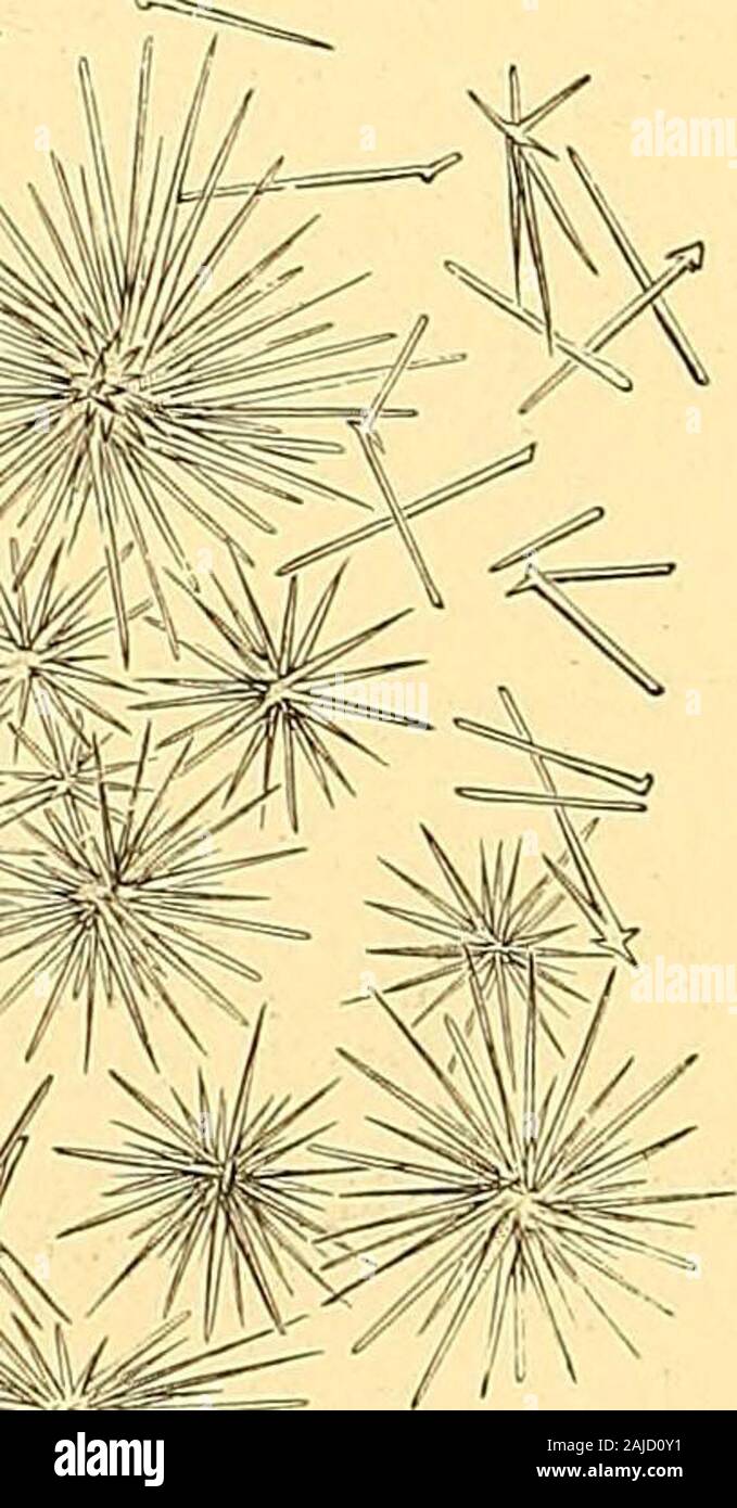 Amorphous Urates In Urine