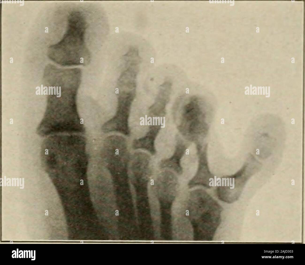 Plastic surgery; its principles and practice . Fig. 183 ...