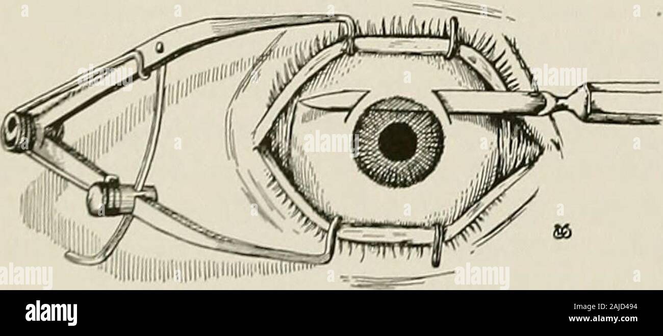 Surgical treatment; a practical treatise on the therapy of surgical ...