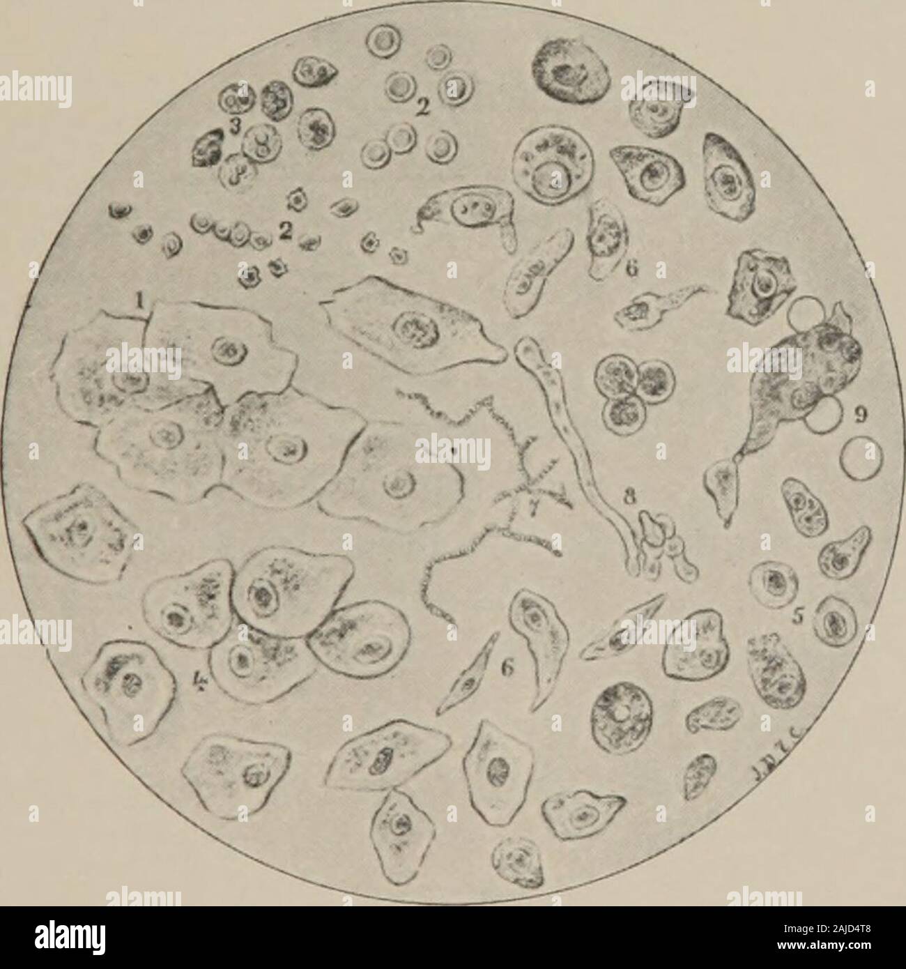 Pyelitis hi-res stock photography and images - Alamy