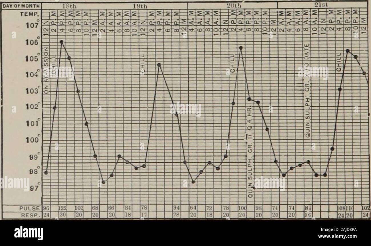 Epigastrium hi-res stock photography and images - Alamy