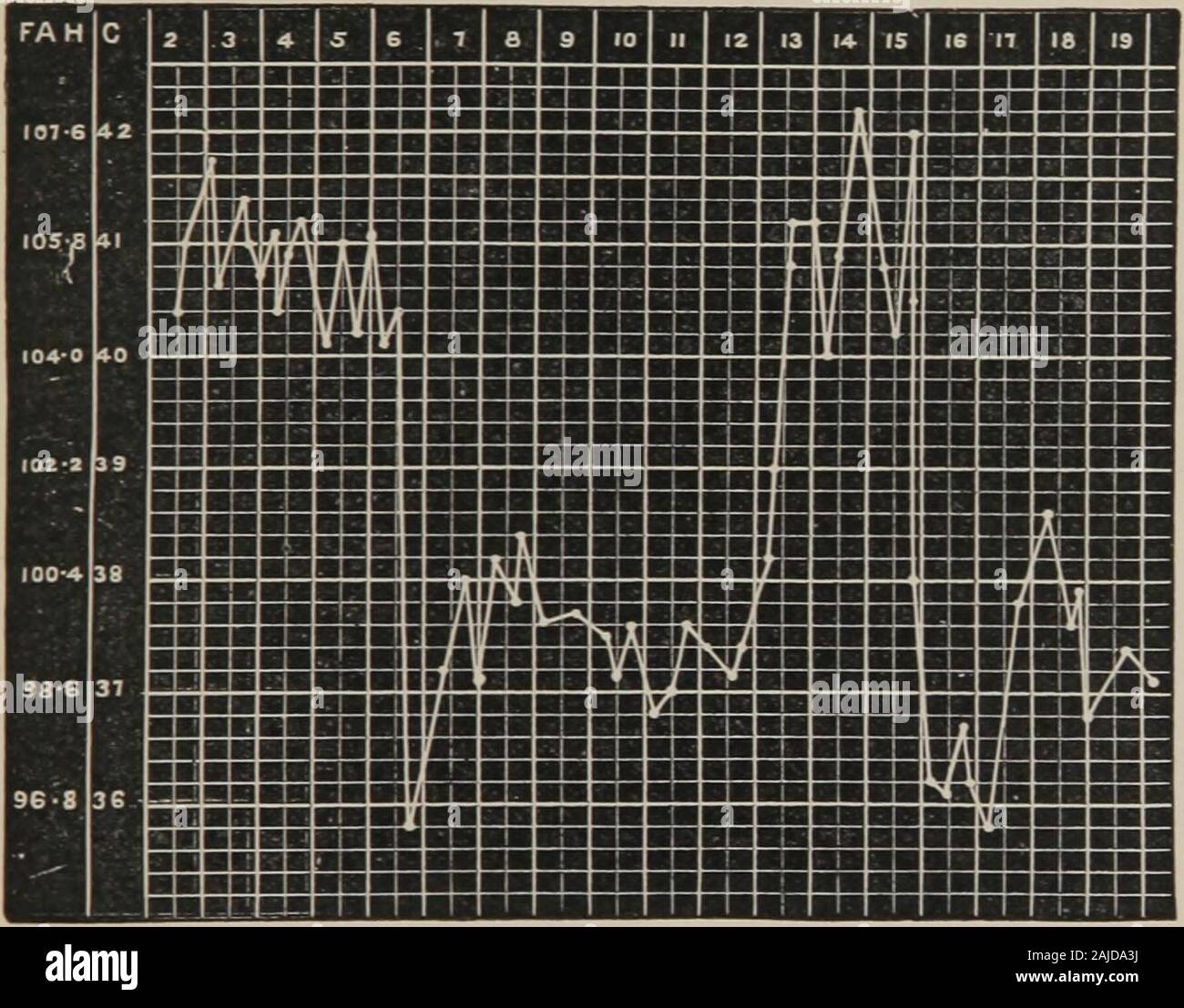 104 fever hi-res stock photography and images - Alamy