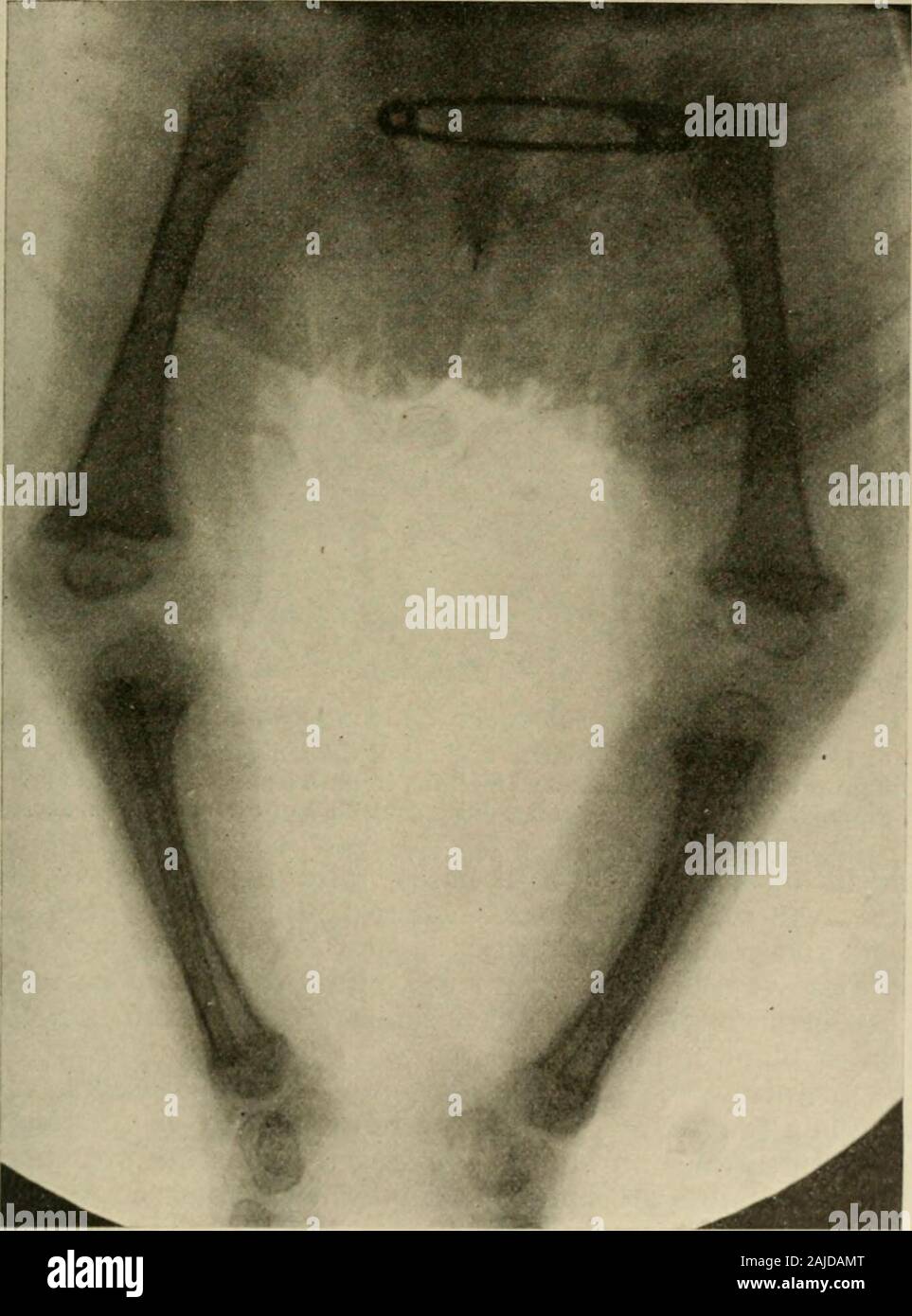 The diseases of infants and children . Fig. 213.—Ixfaxtile Scurvy ...