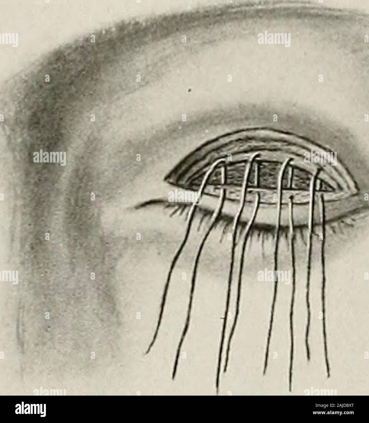 Surgical treatment; a practical treatise on the therapy of surgical ...