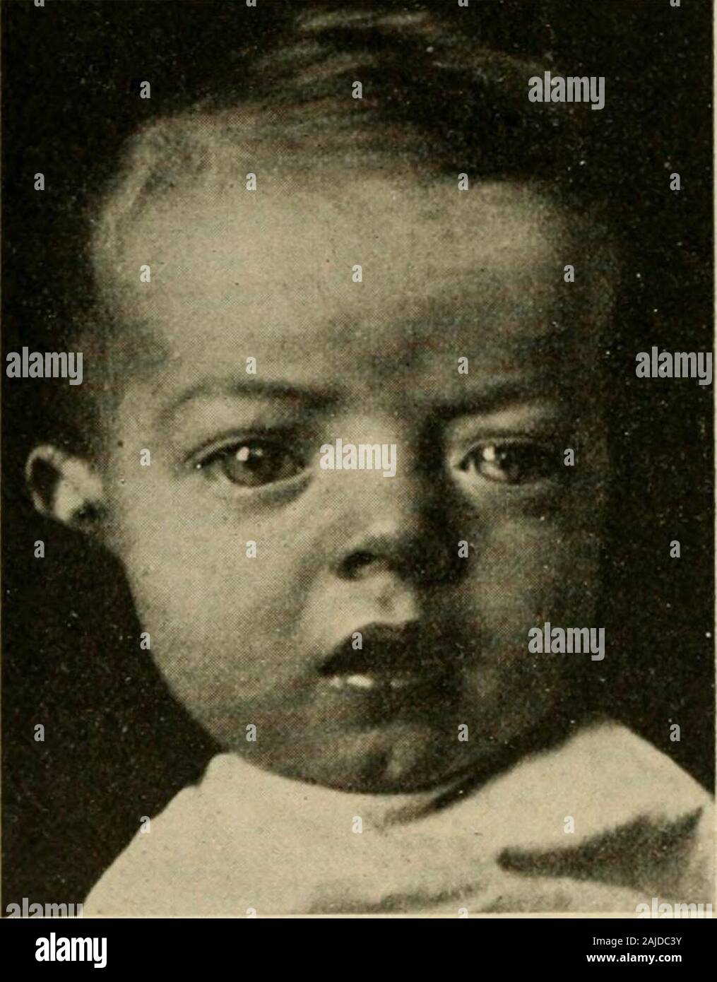 Rickets Head High Resolution Stock Photography and Images - Alamy