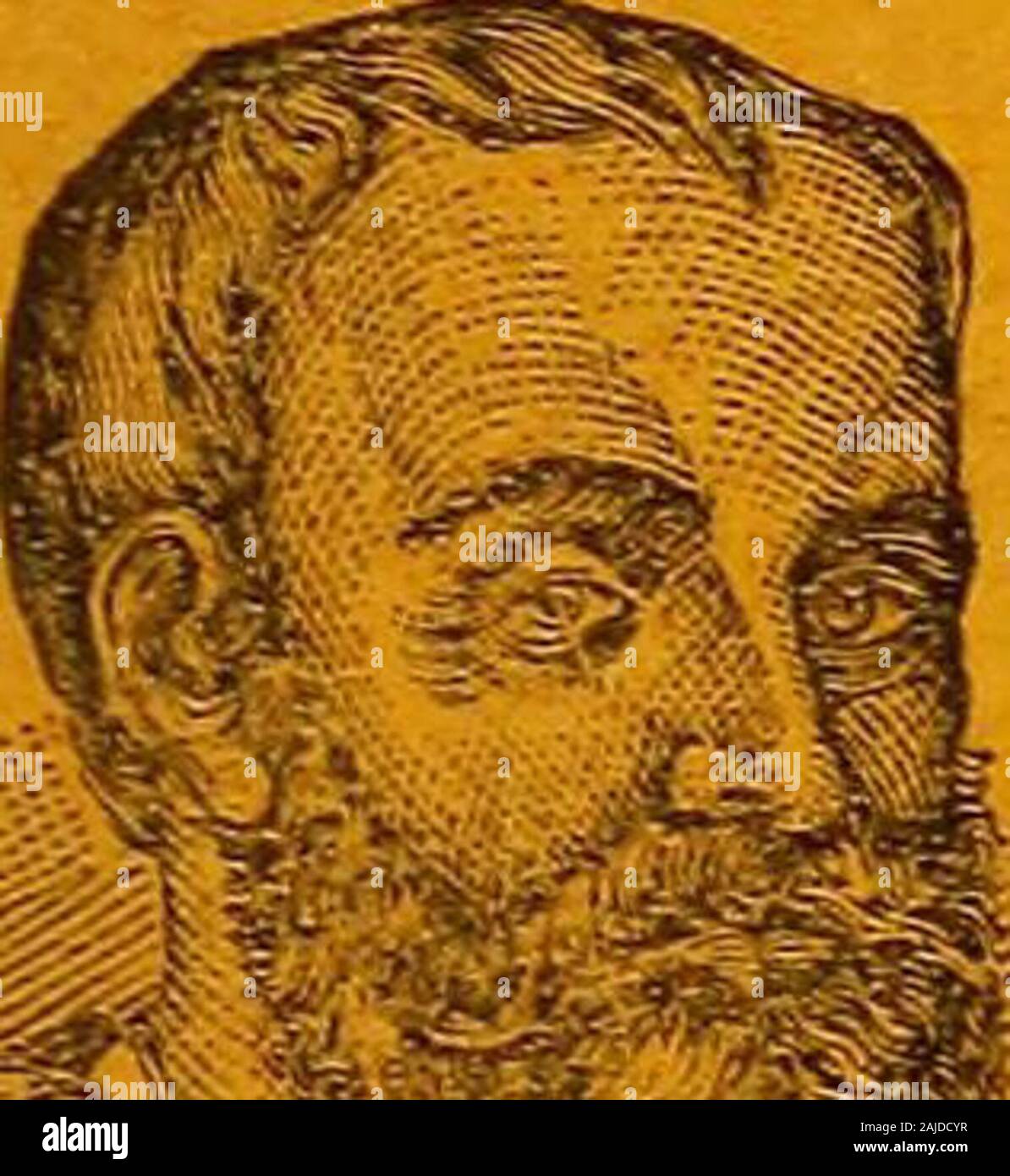 Venesection hi-res stock photography and images - Alamy