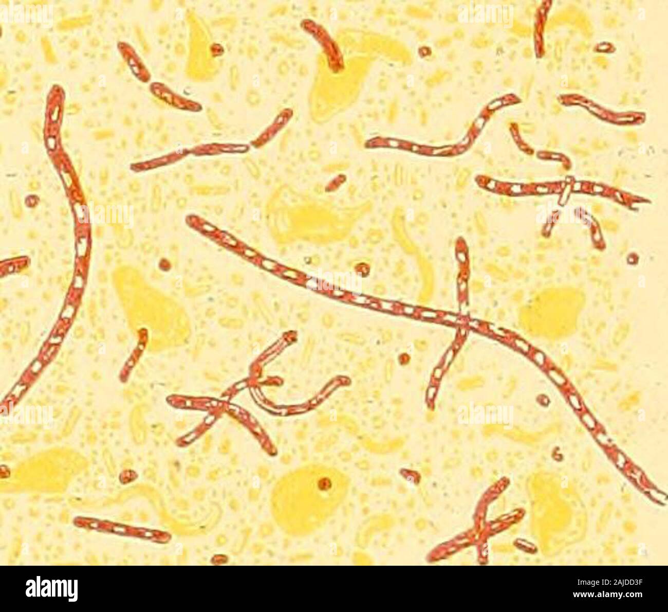 Iodine stain hi-res stock photography and images - Alamy