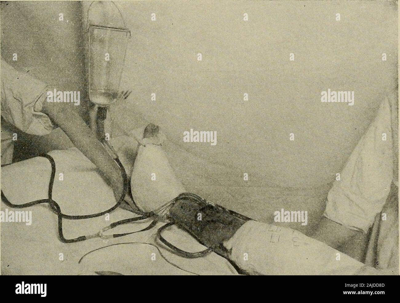 Suppurating hi-res stock photography and images - Alamy