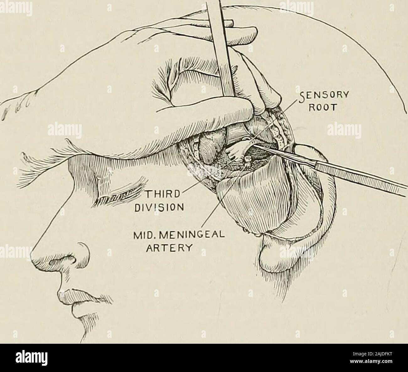 Surgical treatment; a practical treatise on the therapy of surgical ...