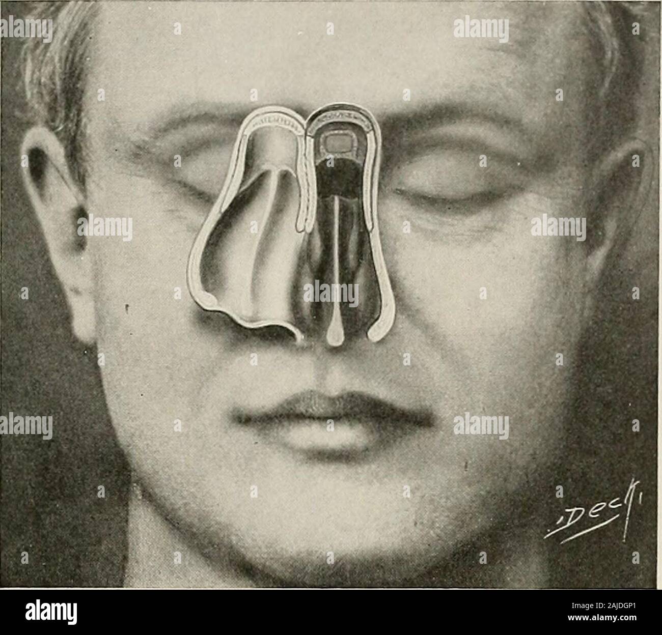 Surgical treatment; a practical treatise on the therapy of surgical ...