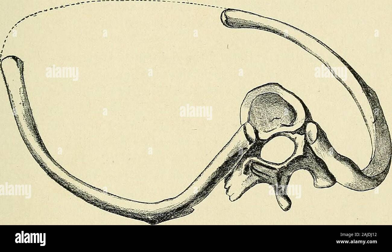 Lateral deviation hi-res stock photography and images - Alamy