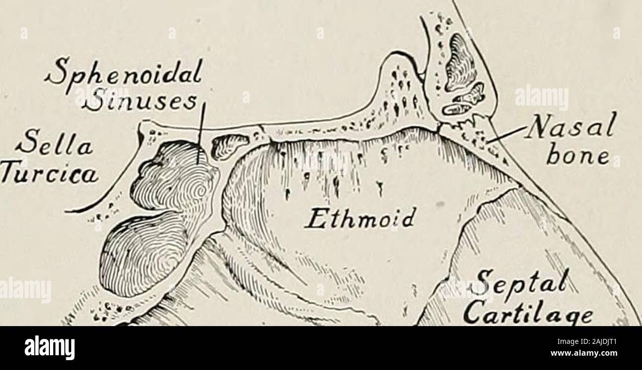 Sphenoidal sinus hi-res stock photography and images - Alamy